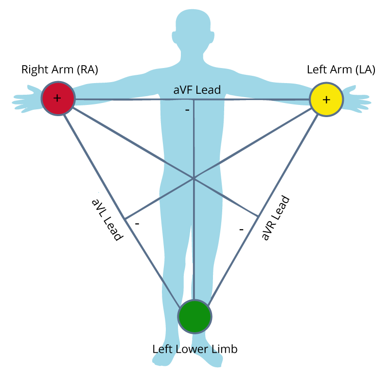 HP202 6-lead Wearable ECG Monitor - PCARDIO Wearables